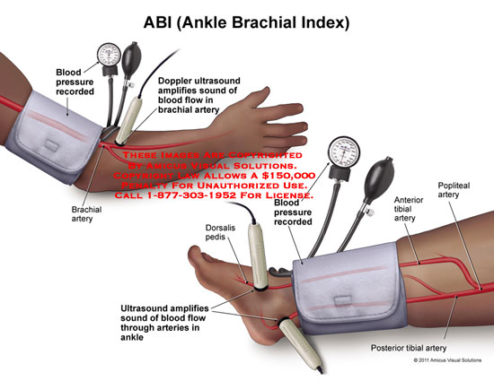  ABI Index 98ececef Udn 